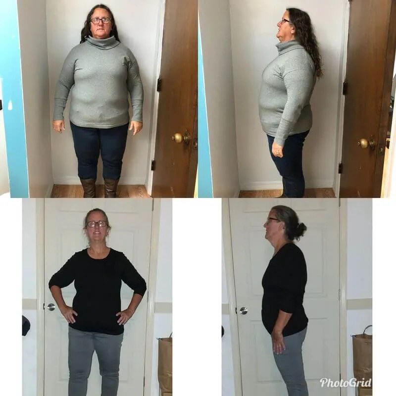 Fast Weight Loss Results and Before and Afters | Orlando, Florida
