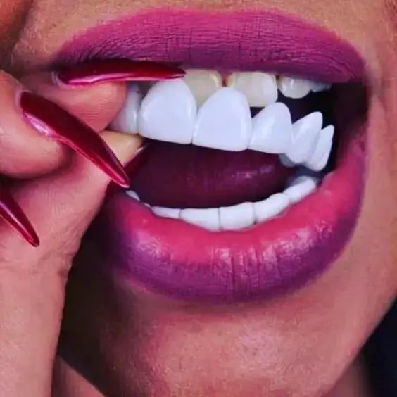 Instant Smile Snap On Veneers (Upper & Lower) Teeth Veneers