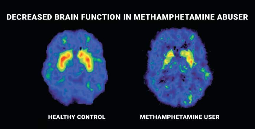 Drug Rehab Success Rate - St. Louis Drug and Alcohol Treatment Center ...