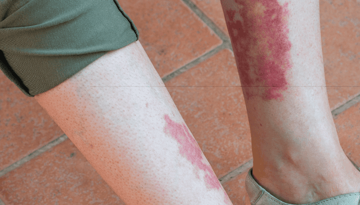 How to Recover from a Disney Park Day: Post-Disney Day Routine - Julia ...