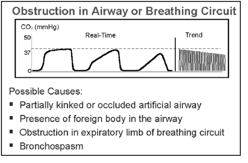 So much hot gas - ETCO2 for non-anaesthetists - KI Doc