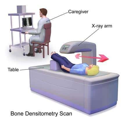 How Do DEXA Scans Work? The Science Behind Bone Mineral Density Tests