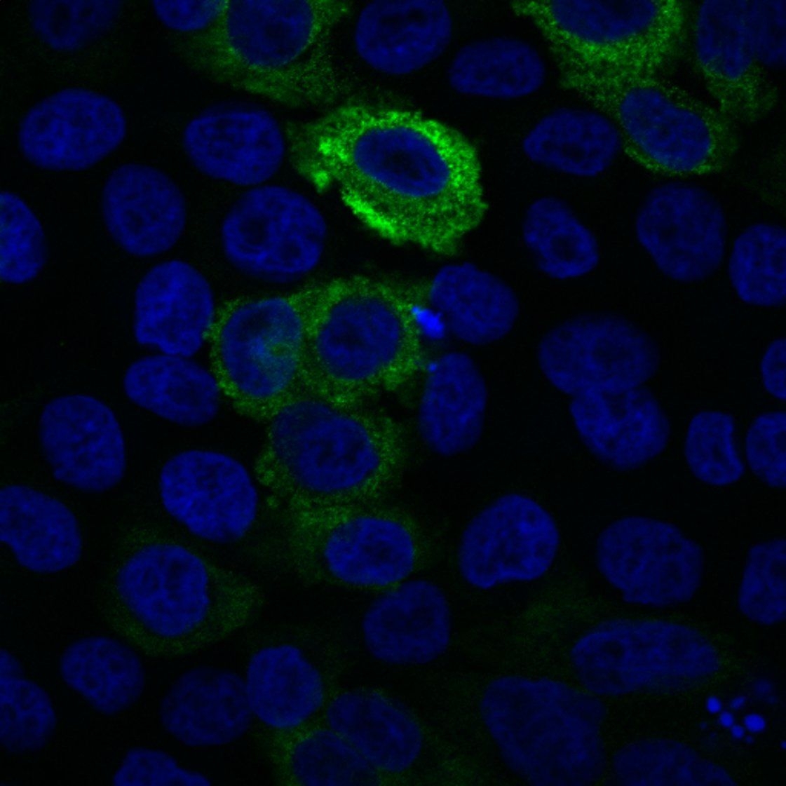 GFP uses in research