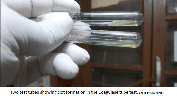 Coagulase test procedure complete guide 2023