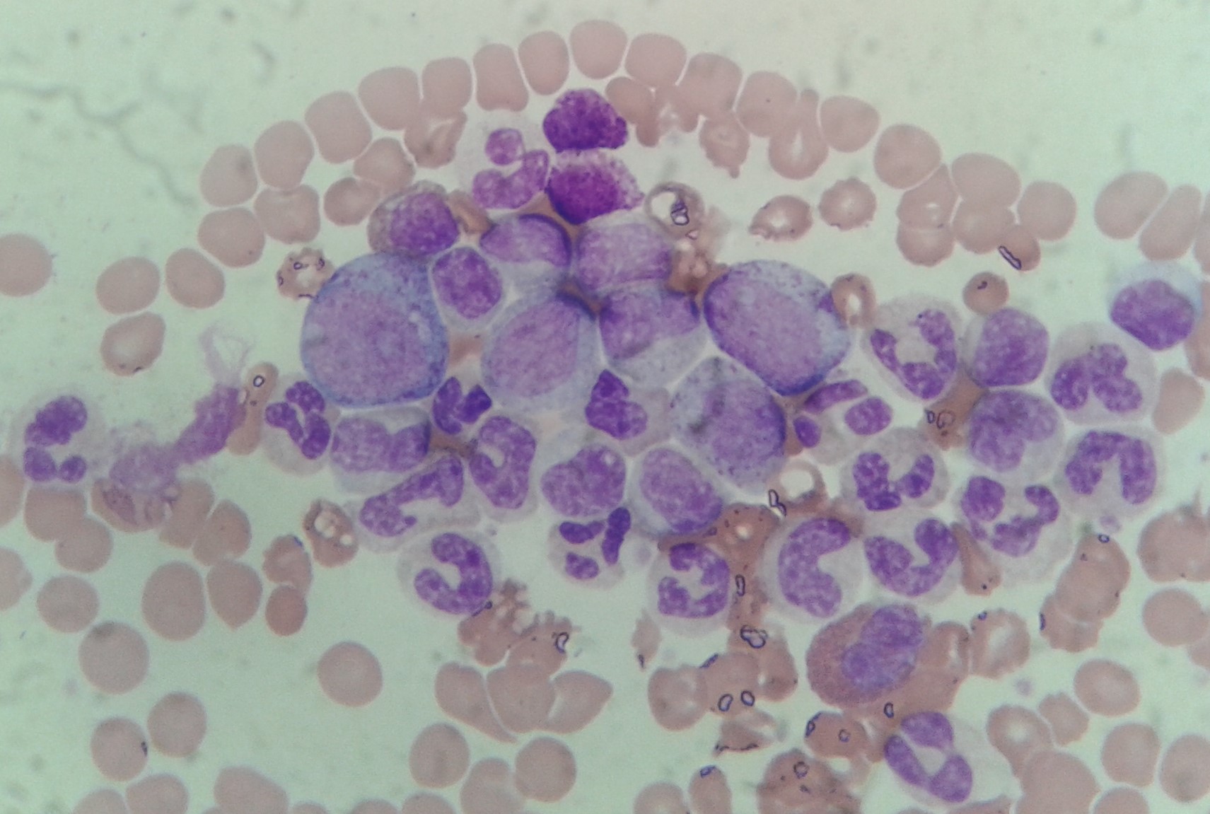 Caso Clínico 02 | LAB Prática