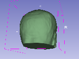Overview 3d Slicer Segmentation Recipes