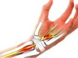 Carpal Tunnel Syndrome Physiotherapy Learning Physio