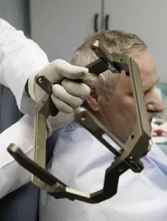 Head Gamma Knife Market