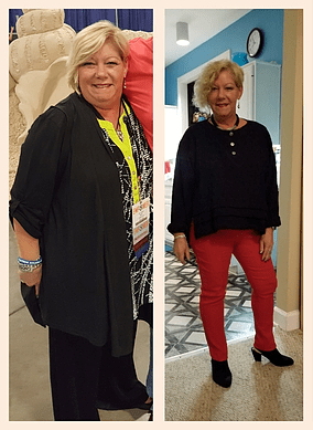 Trifecta Light | LipoMelt Pro