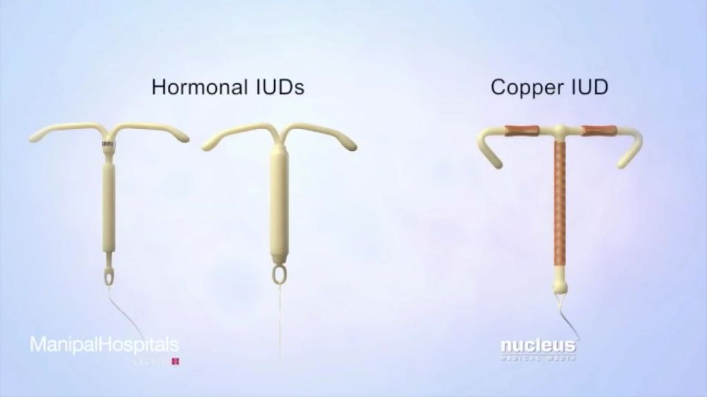 Iud Contraceptive Device Types Insertion Removal Risks 49 Off
