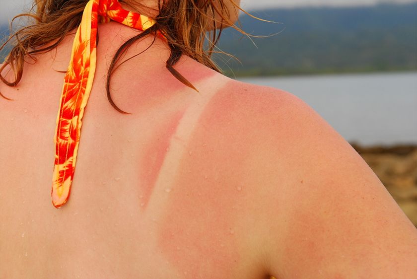 Gen Z Bringing Back Bikini Tan Lines In New Fashion Trend Abc Listen