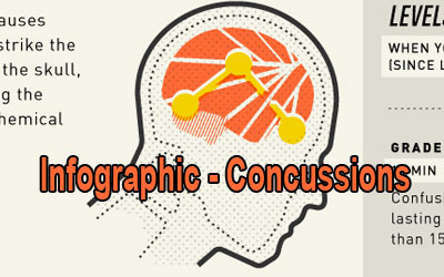 Infographic – The Real Dangers of Concussions - Lone Star Gridiron