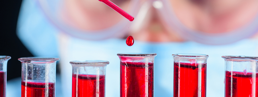 Groundbreaking Research Looks at Blood-Based Biomarkers and TBI - Mid ...