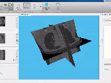 Image Processing Computer Vision Solutions Development