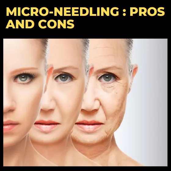 Micro Needling : Pros and Cons - MAXIMUS GLOBE