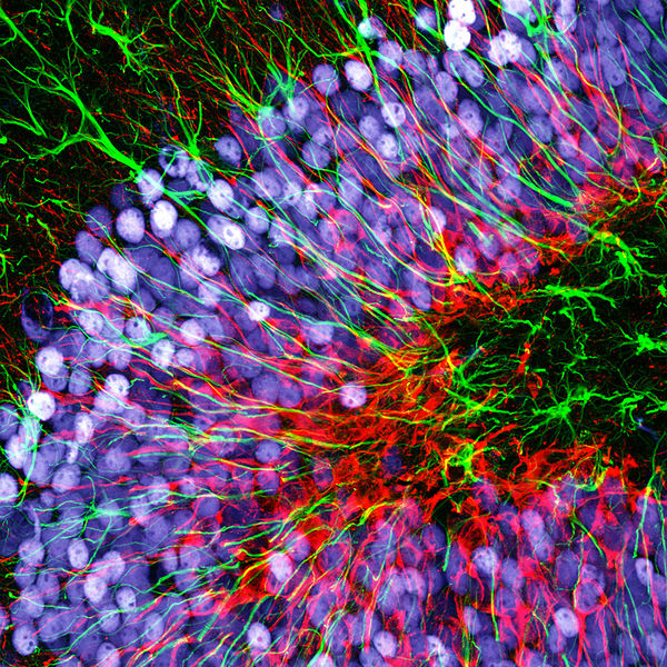 First-ever LSD microdosing study on its way / Boing Boing