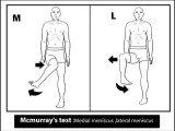 Knee Examination Osce Prep Medstudentnotes