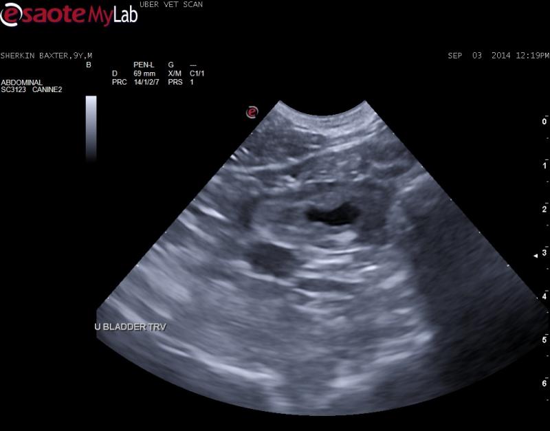 Apical Bladder Lesion - Members