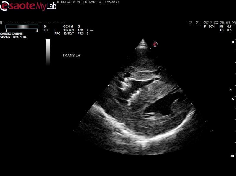 Right to left VSD, right ventricular hypertrophy, and RA dilation in a ...