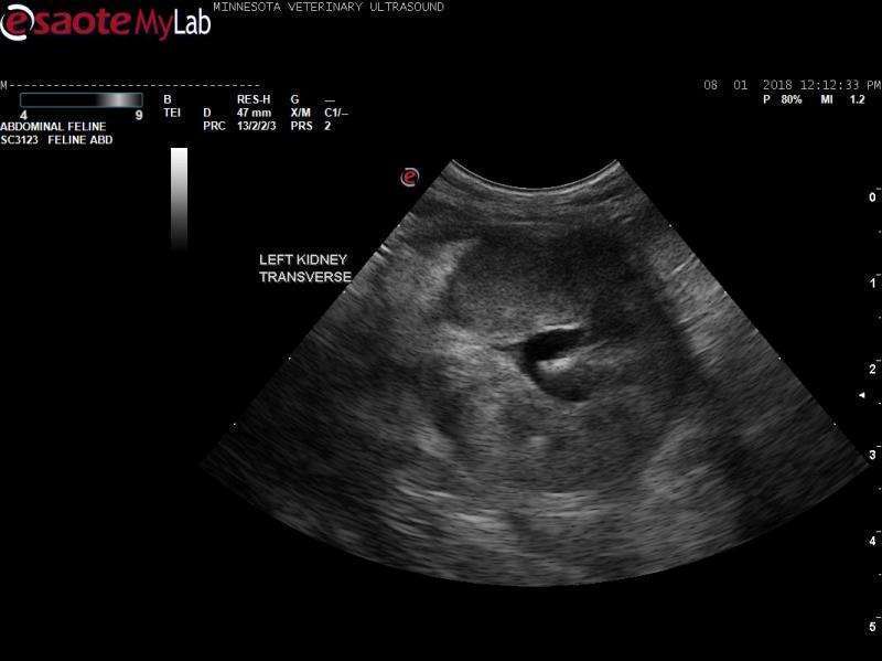 Perirenal inflammation and renal pelvic dilation - Members