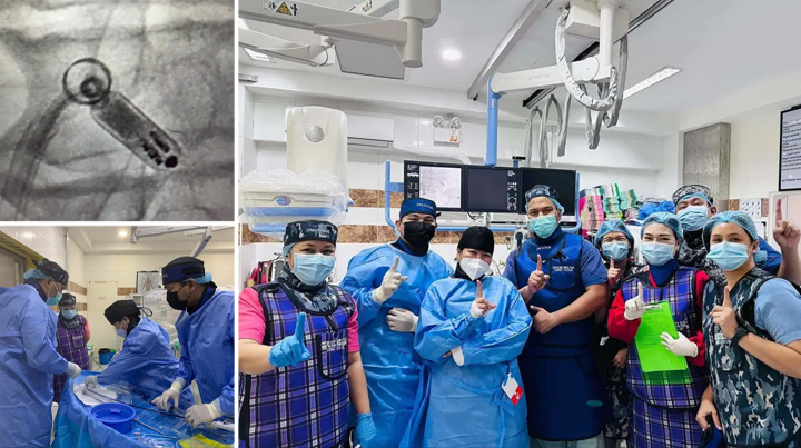 CDO Polymedic Medical Plaza performs first Leadless Pacemaker Implantation in Northern Mindanao ...