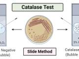 Catalase Test Principle Procedure Types Results Uses