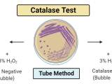 Catalase Test Principle Procedure Types Results Uses