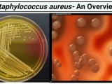 Staphylococcus Aureus An Overview Microbe Notes