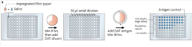 Lab Diagnosis of Visceral Leishmaniasis (Kala-Azar) • Microbe Online