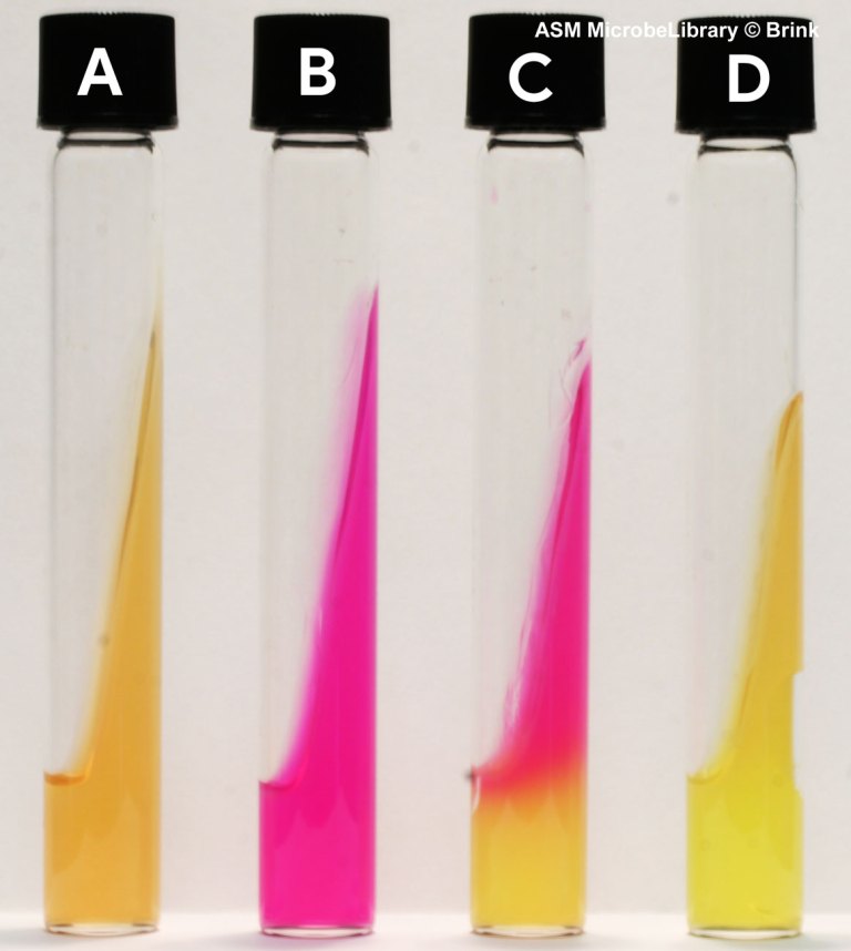 Urease Test: Principle, Procedure, Results • Microbe Online
