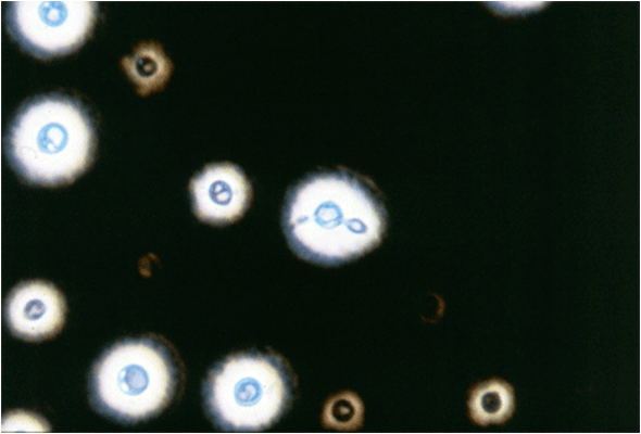 Cryptococcus neoformans: Pathogenesis, Lab Diagnosis