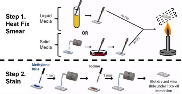 Simple Staining: Principle, Procedure, Uses • Microbe Online