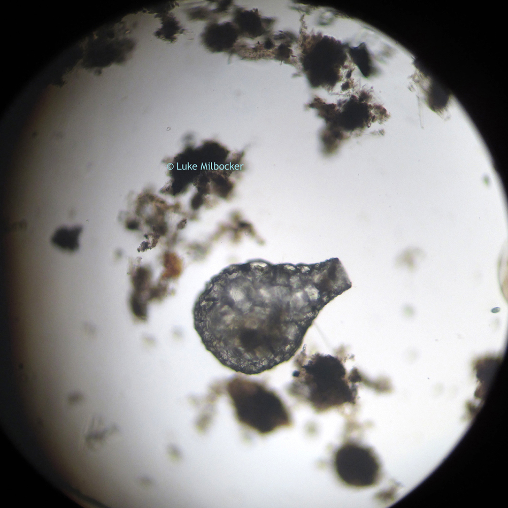 Microscopy Protozoans | Microbus Microscope Educational Website