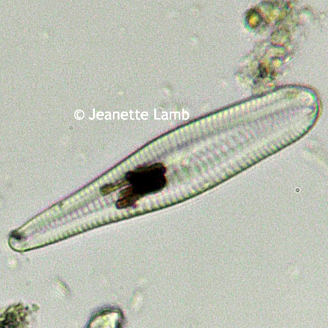 Microscopy Pond Water Critters | Microbus Microscope Educational Website