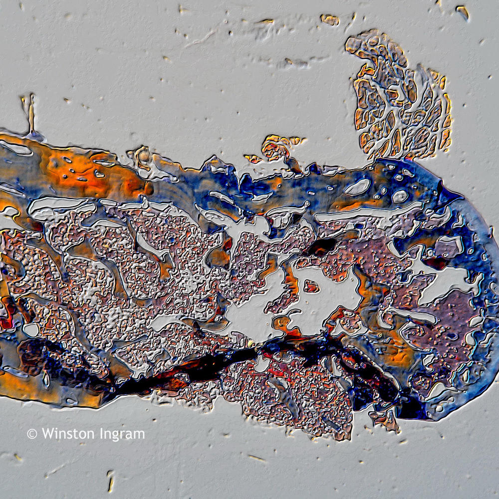 Microscopy Opthalmalic Dental | Microbus Microscope Educational Website