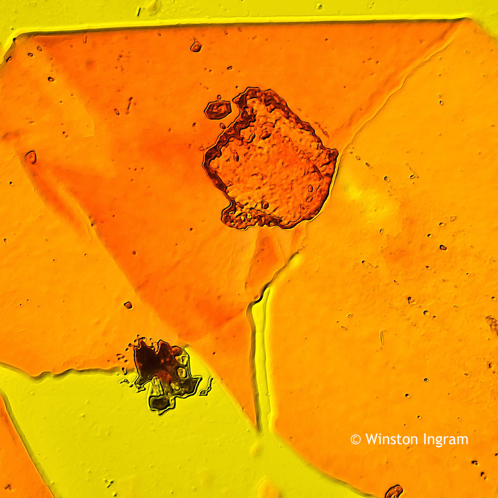 Microscopy Opthalmalic Dental | Microbus Microscope Educational Website