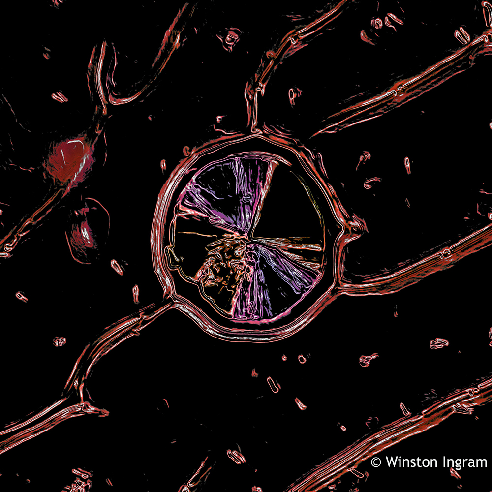 Microscopy Wood | Microbus Microscope Educational Website