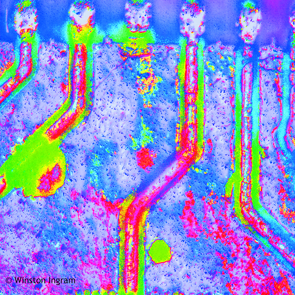 Microscopy Electronic Circuits | Microbus Microscope Educational Website