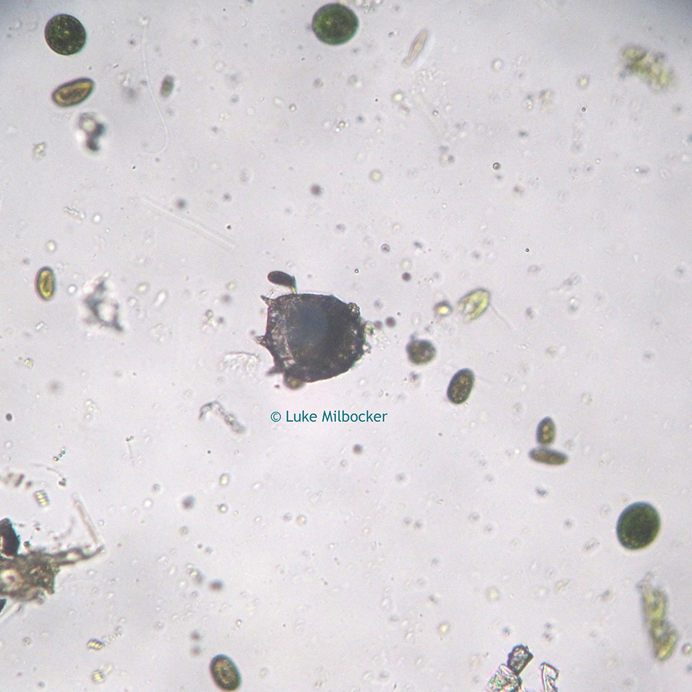 Microscopy Protozoans | Microbus Microscope Educational Website