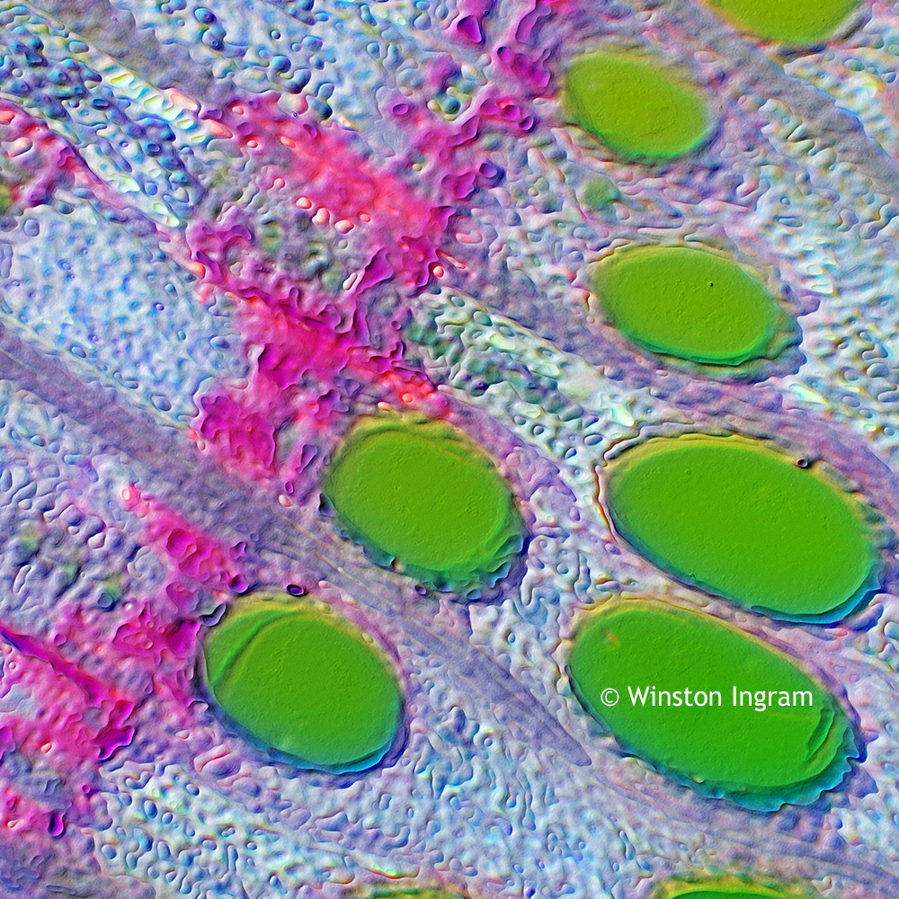 Microscopy Wood | Microbus Microscope Educational Website