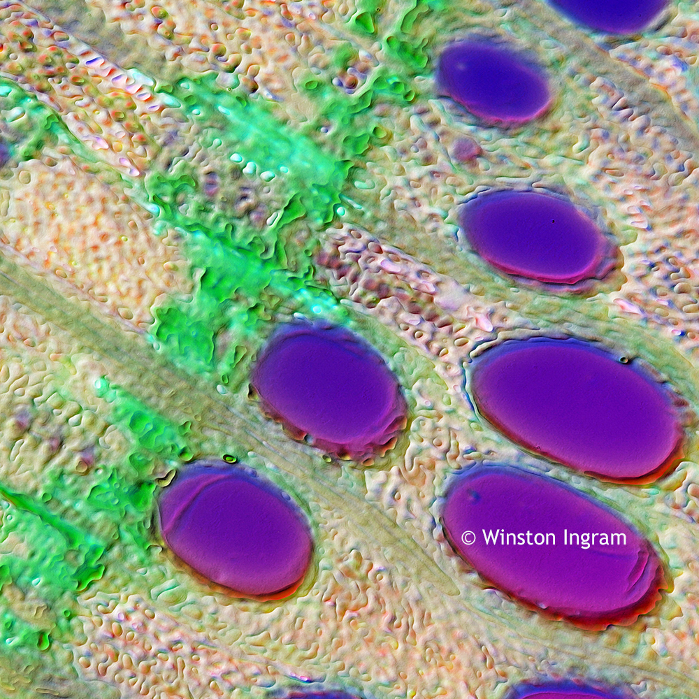 Microscopy Wood | Microbus Microscope Educational Website