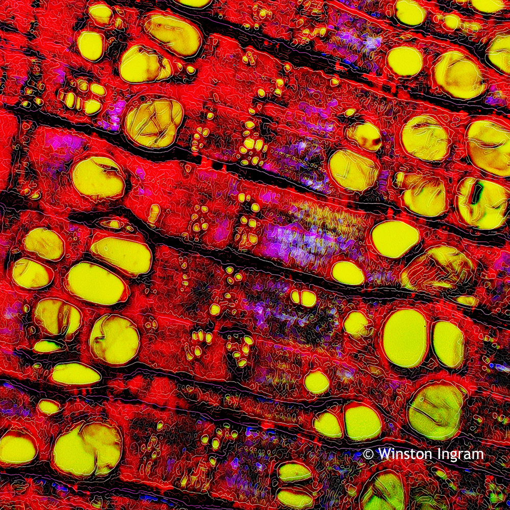 Microscopy Wood | Microbus Microscope Educational Website