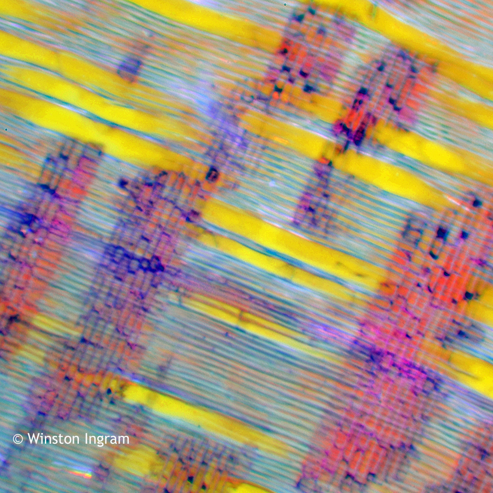 Microscopy Wood | Microbus Microscope Educational Website