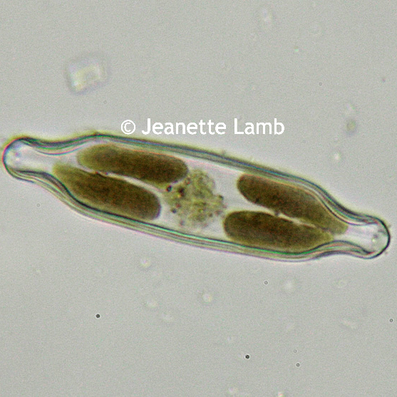 Microscopy Pond Water Critters | Microbus Microscope Educational Website