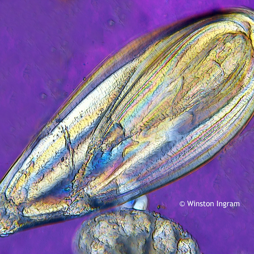 Microscopy Foraminifera | Microbus Microscope Educational Website