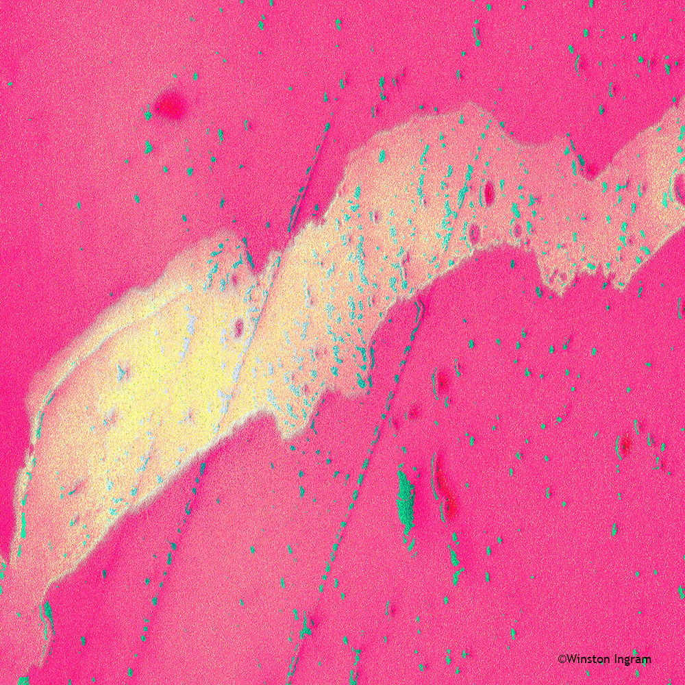 Bricks | Microbus Microscope Educational Website