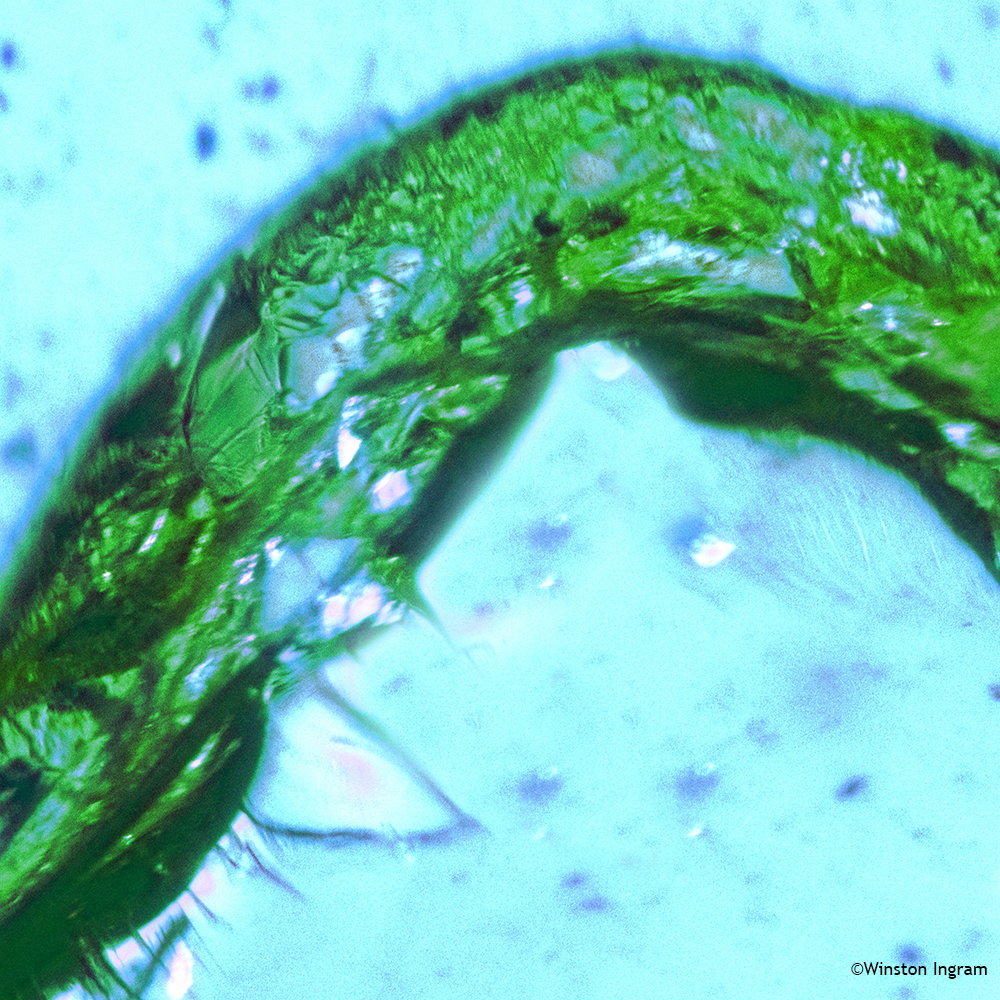 Bricks | Microbus Microscope Educational Website