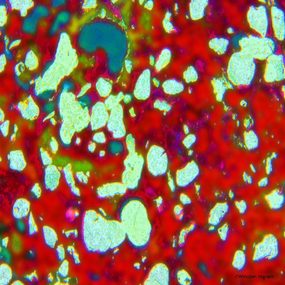 Bricks | Microbus Microscope Educational Website