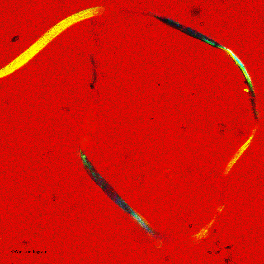 Bricks | Microbus Microscope Educational Website