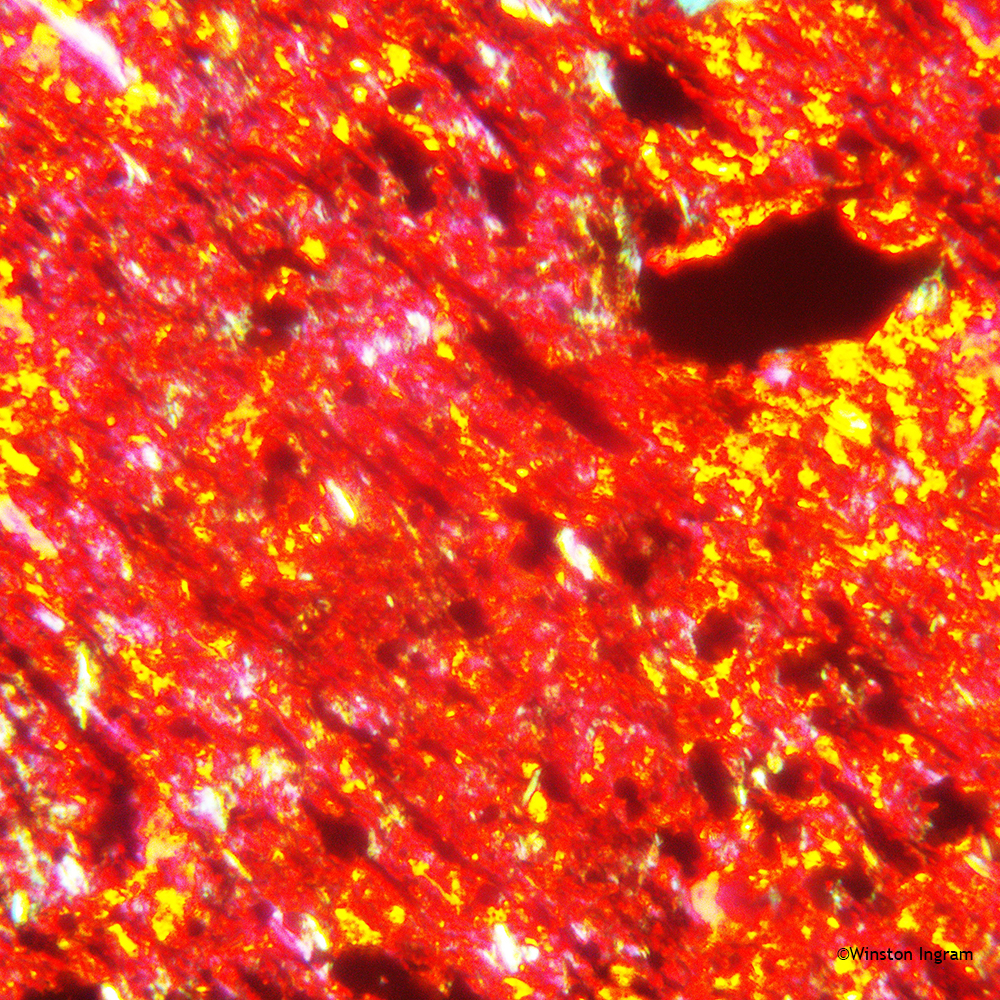 Bricks | Microbus Microscope Educational Website